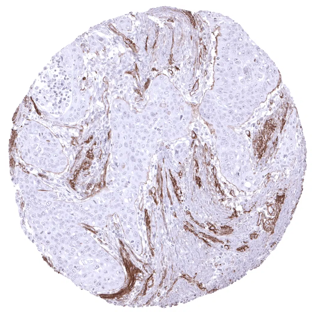 Cancer Tissue Gallery- GTX04434 | GeneTex
