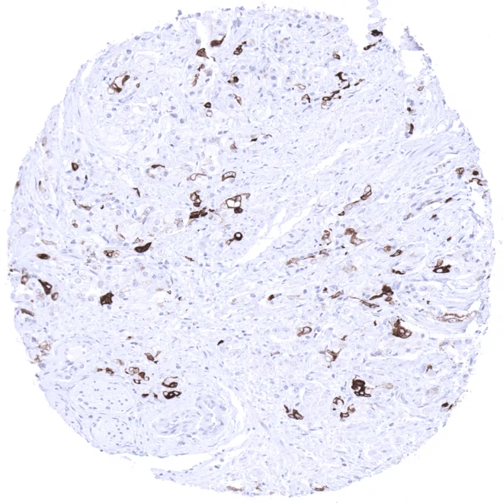 Cancer Tissue Gallery- GTX04376 | GeneTex