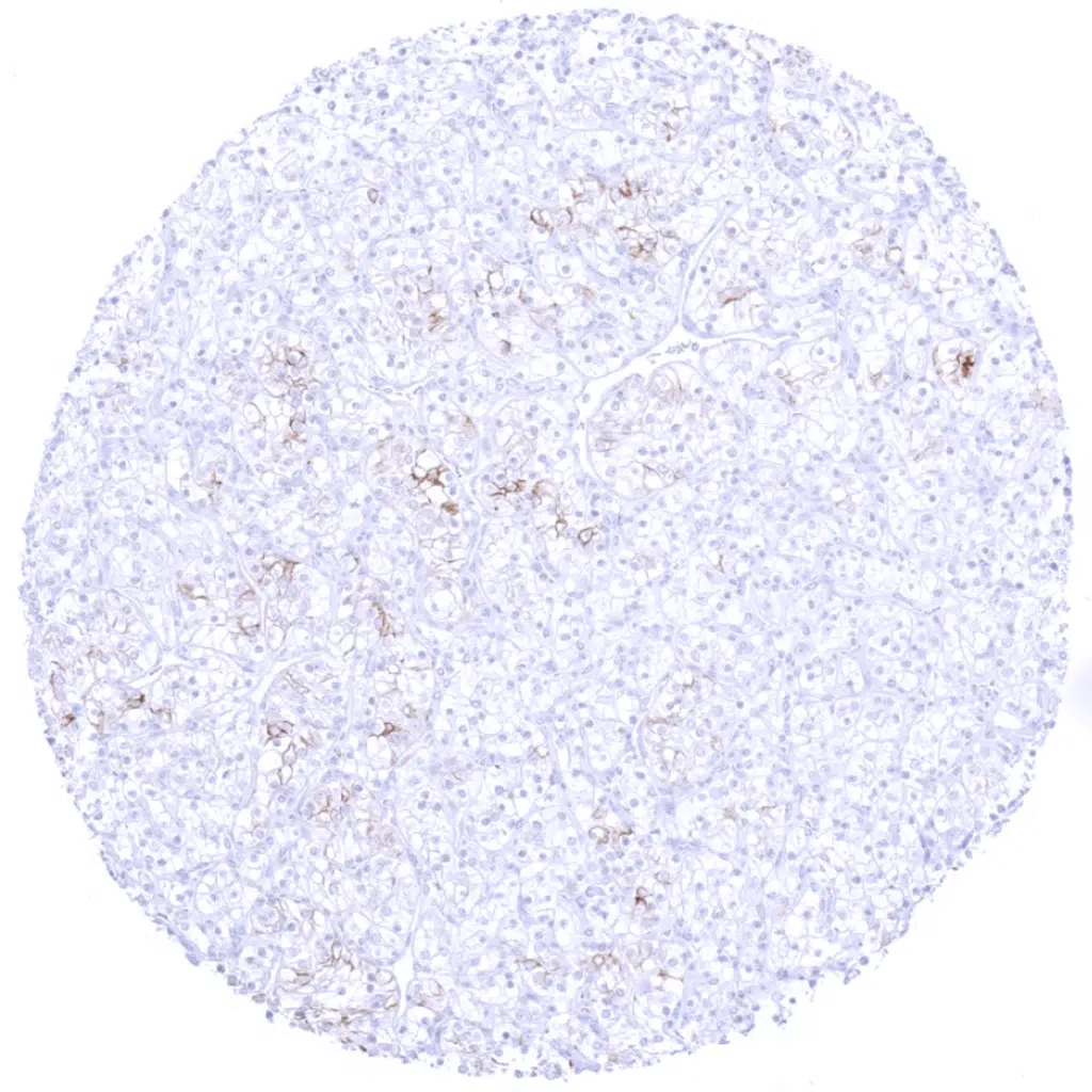 Cancer Tissue Gallery- GTX04375 | GeneTex