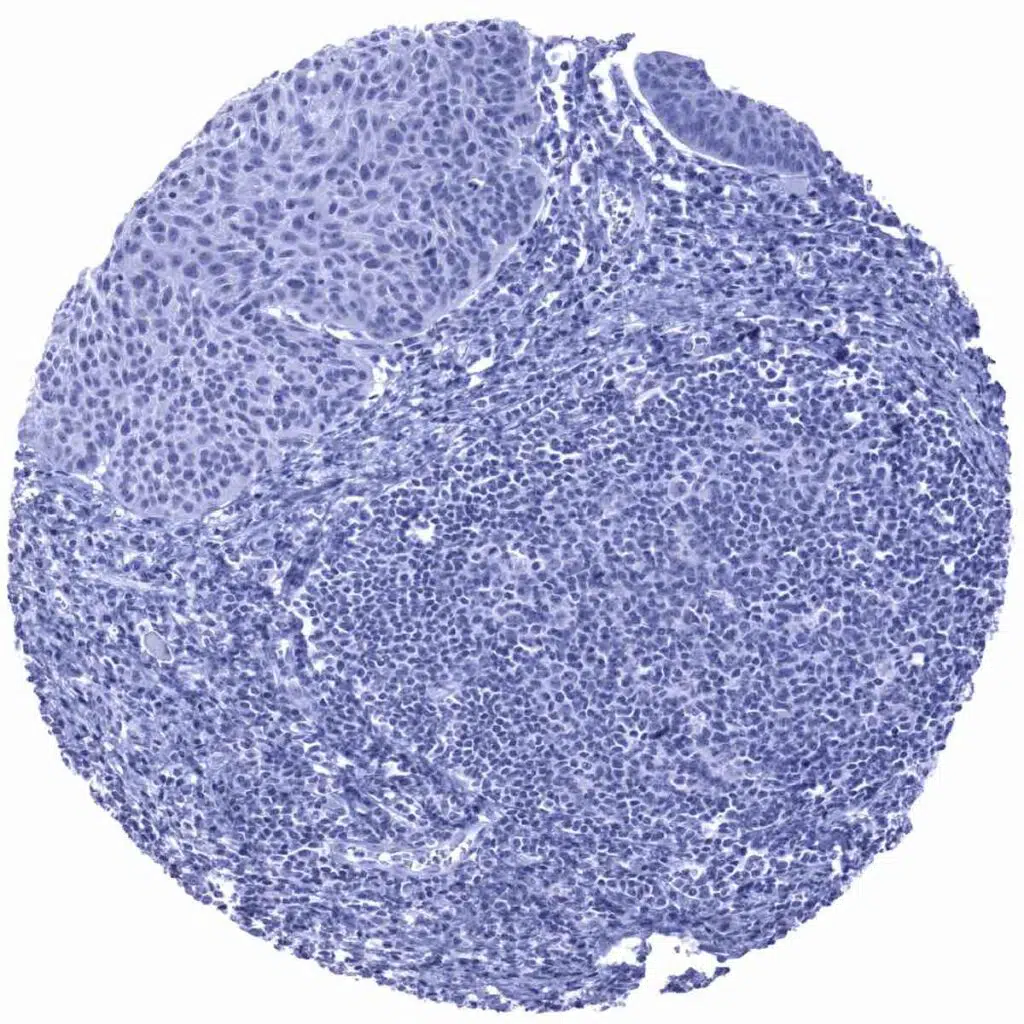 Cancer Tissue Gallery- GTX04478 | GeneTex