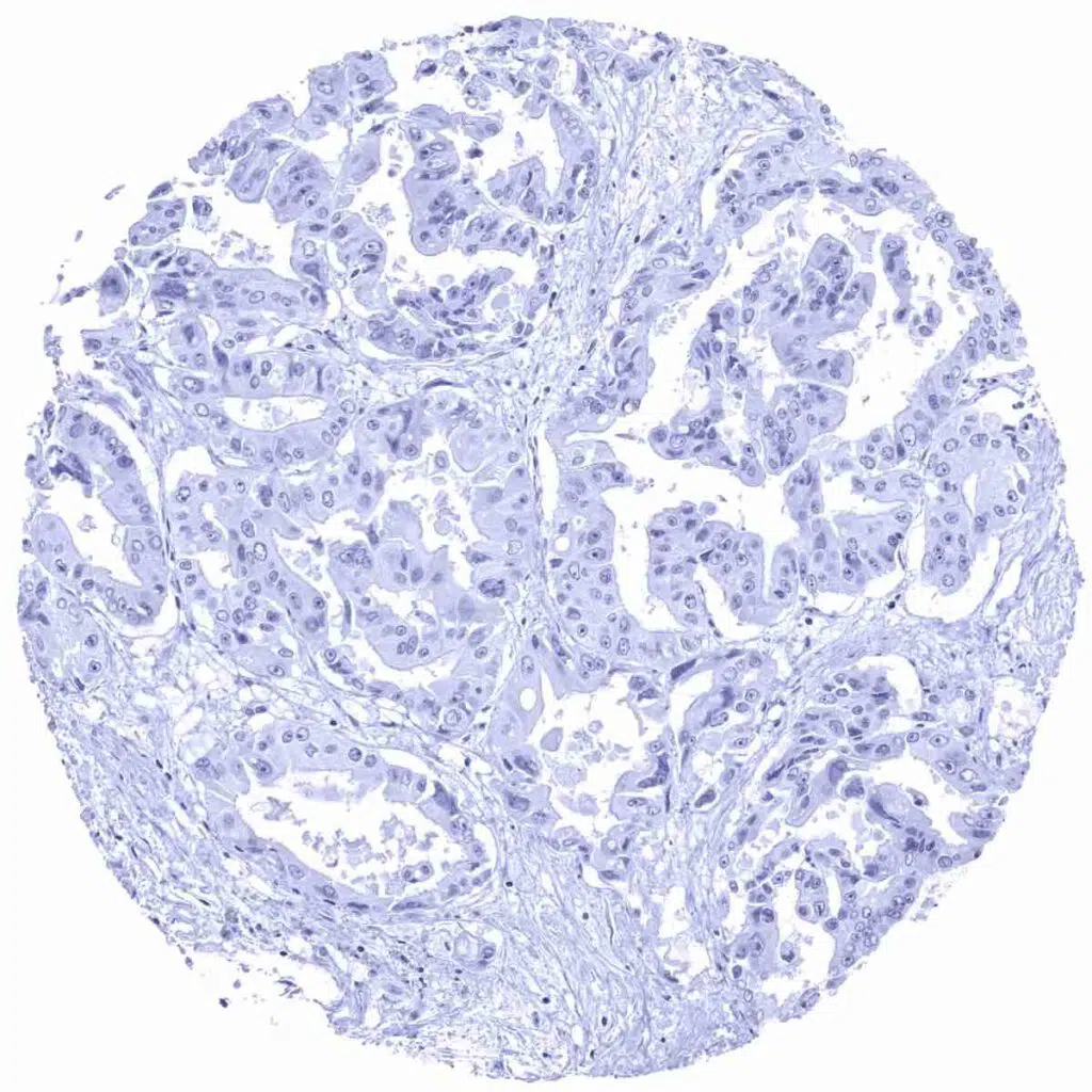 Cancer Tissue Gallery- GTX04478 | GeneTex