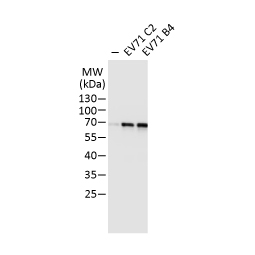Enterovirus 71 | GeneTex