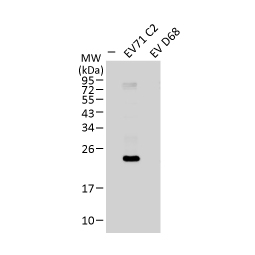 Enterovirus 71 | GeneTex