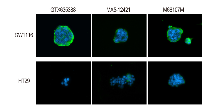 Pancreatic Cancer Tumor Markers | GeneTex