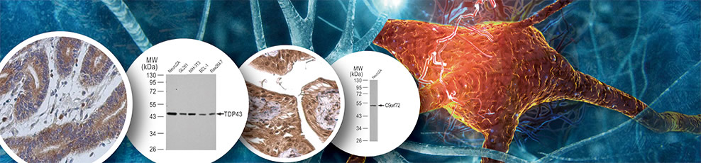 Amyotrophic Lateral Sclerosis | GeneTex