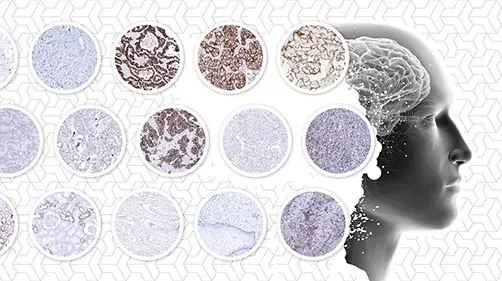 Antibodies, Proteins, Lysates, and Research Reagents | GeneTex