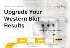 Primary Antibodies | GeneTex