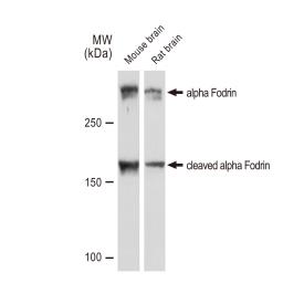 Anti-alpha Fodrin antibody [GT1261] (GTX02858) | GeneTex