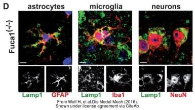 Anti-Iba1 antibody (GTX100042) | GeneTex
