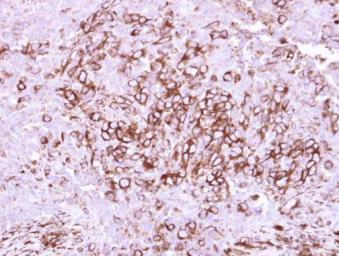 Anti-CD40 antibody (GTX101447) | GeneTex