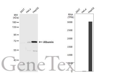 Anti-Albumin antibody (GTX102419) | GeneTex