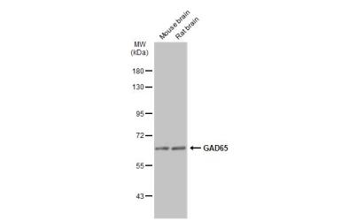 Anti-GAD65 antibody (GTX113192) | GeneTex