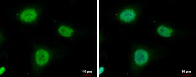 Anti-IMP3 antibody (GTX115459) | GeneTex