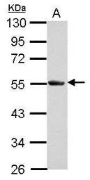 Anti-SLA/LP antibody (GTX123307) | GeneTex