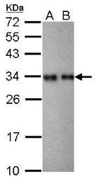Anti-Rpl7a antibody (GTX124314) | GeneTex