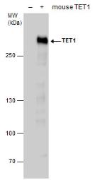 Anti-TET1 antibody [N1], N-term (GTX125888) | GeneTex