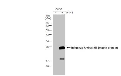 Anti-Influenza A virus M1 (matrix protein) antibody (GTX127356) | GeneTex