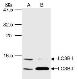 Anti-LC3B antibody (GTX127375) | GeneTex