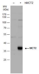 Anti-MCT2 antibody (GTX129600) | GeneTex