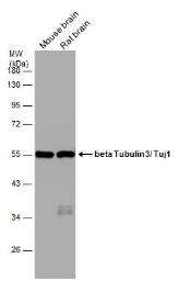 Anti-beta Tubulin 3/ Tuj1 antibody (GTX129913) | GeneTex
