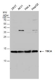 Anti-TBCA antibody (GTX130832) | GeneTex