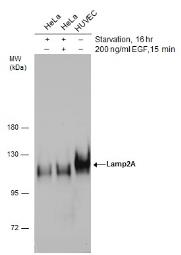 Anti-LAMP2A antibody (GTX132655) | GeneTex