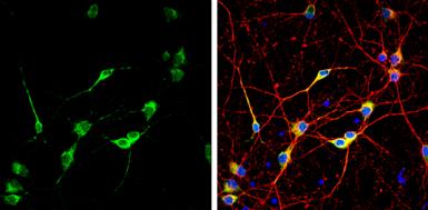 Anti-CGRP antibody (GTX134005) | GeneTex