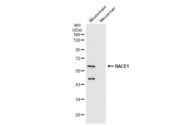 Anti-BACE1 antibody (GTX134480) | GeneTex