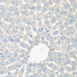 Anti-C3 / C3c antibody (GTX33050) | GeneTex