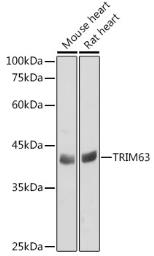 Anti-MURF1 antibody (GTX33334) | GeneTex