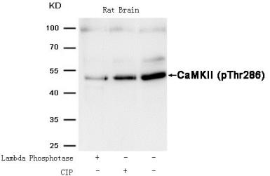 Anti-CaMKII alpha (phospho Thr286) antibody (GTX50307) | GeneTex