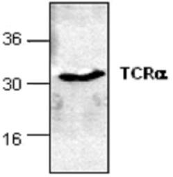 Anti-TCR alpha antibody (GTX59656) | GeneTex