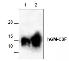 Anti-GM-CSF antibody (GTX59748) | GeneTex