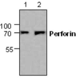 Anti-Perforin antibody (GTX59812) | GeneTex