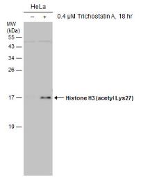 Anti-Histone H3K27ac (Acetyl Lys27) antibody [GT261] (GTX633652) | GeneTex