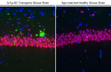 Anti-Beta amyloid (1-42) antibody – Conformation Specific antibody [GT622] (GTX635160) | GeneTex