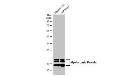 Anti-Myelin basic protein antibody [HL1033] (GTX635873) | GeneTex