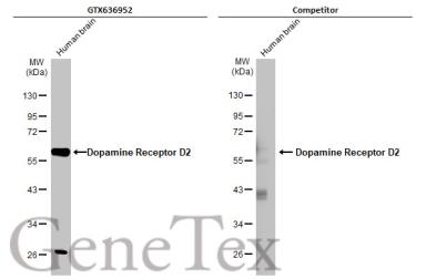 Anti-Dopamine Receptor D2 antibody [HL1478] (GTX636952) | GeneTex