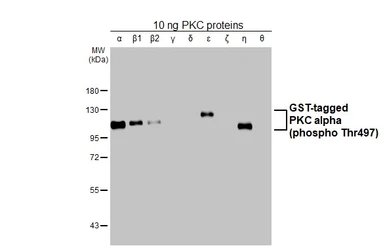 Anti-PKC alpha (phospho Thr497) antibody [HL3605] (GTX641580) | GeneTex