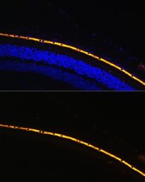 Anti-RPE65 antibody (GTX64456) | GeneTex