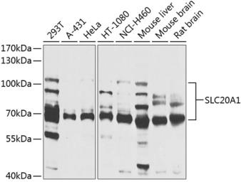 Anti-SLC20A1 antibody (GTX64727) | GeneTex