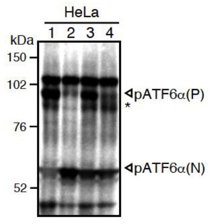 Anti-ATF6 antibody [37-1] (GTX00686) | GeneTex