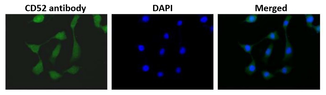 Anti-CD52 antibody (GTX00743) | GeneTex
