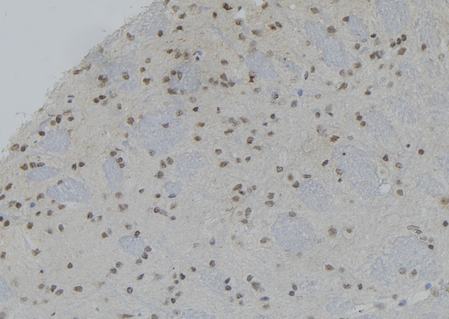 Anti-RUNX2 (phospho Ser275) antibody (GTX00813) | GeneTex