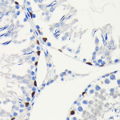 Anti-SOX9 antibody [GT1219] (GTX01545) | GeneTex