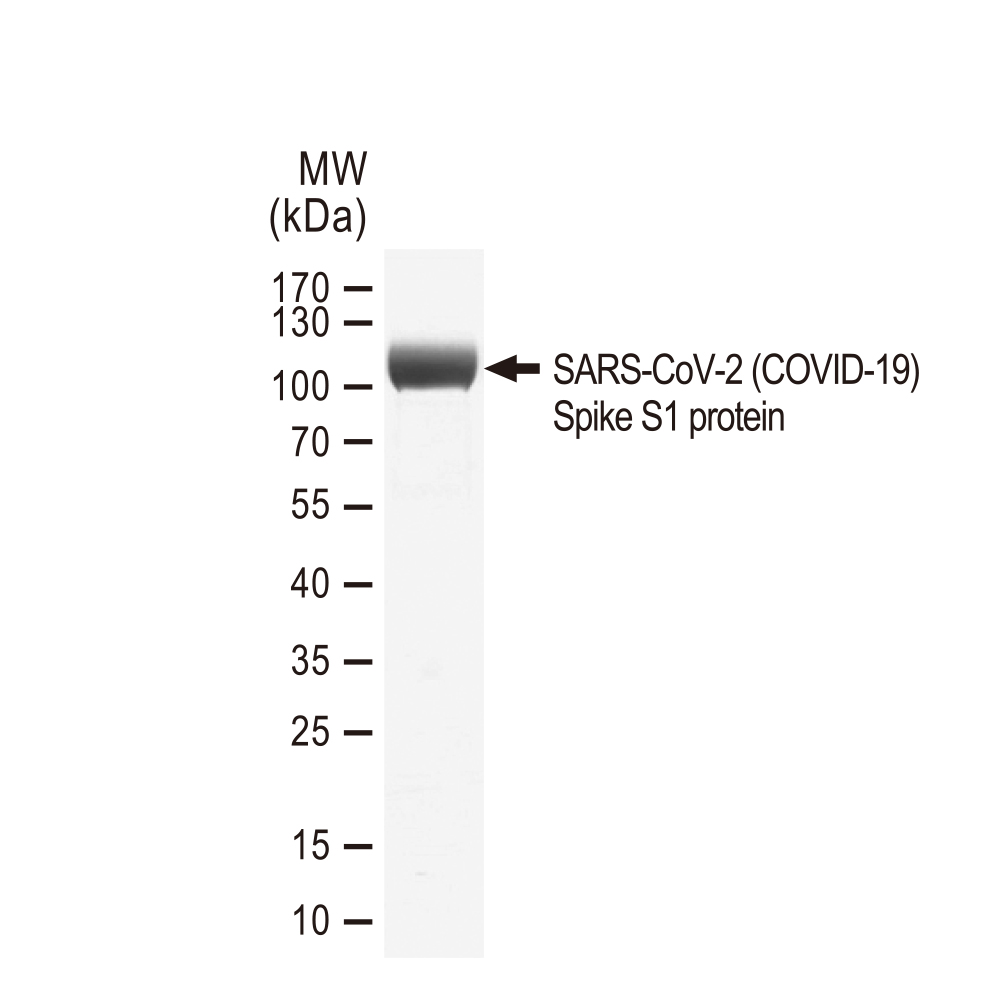 SARS-CoV-2 (COVID-19) Spike S1 protein, His tag (active) (GTX01554-pro ...