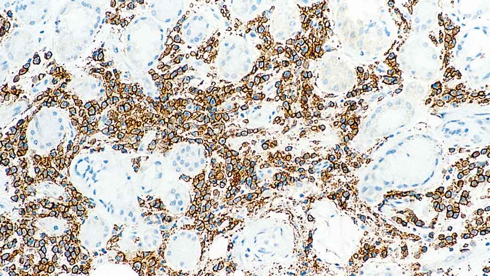 Anti-CD38 antibody [SPC32] (GTX01959) | GeneTex