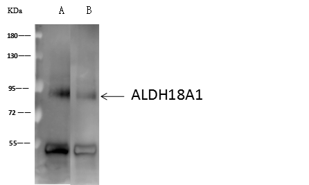 Anti-ALDH18A1 antibody (GTX02421) | GeneTex