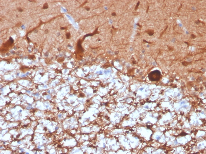 Anti-PGP9.5 antibody [UCHL1/4556R] (GTX02737) | GeneTex