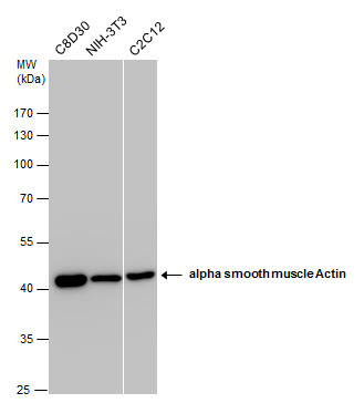 Anti-alpha Smooth Muscle Actin antibody (GTX100034) | GeneTex